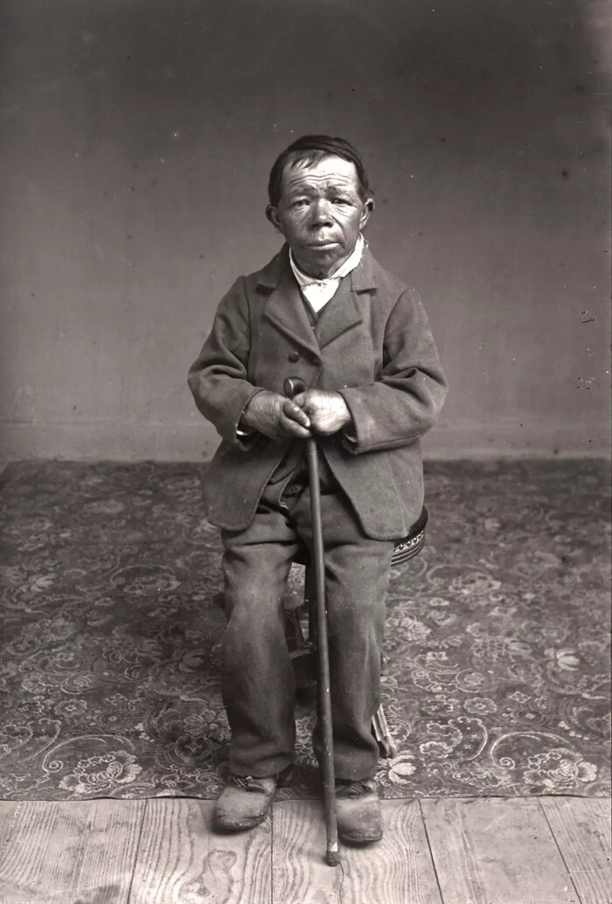 Significado de «cretinismo»